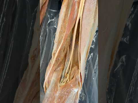 What’s In the Back of Your Knee!?