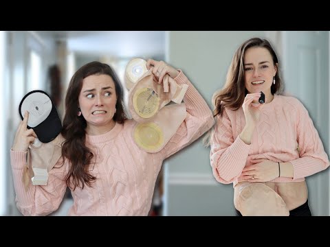 Ostomy Bags Have Too Many Features - How to Choose Your System! | Let's Talk IBD