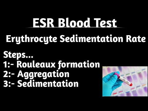 Hematology! ESR test in hindi, Erythrocyte Sedimentation Rate Test,#hematology