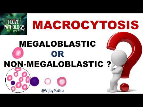 MACROCYTOSIS. Causes, Mechanism & Approach