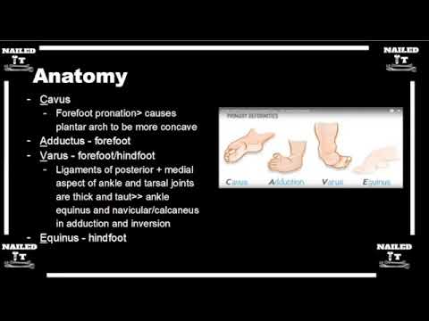 What is clubfoot? CAVE w/ Dr. Gantsoudes