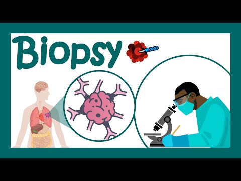 Biopsy | What are biopsies used to diagnose? | How many types of biopsy are there?