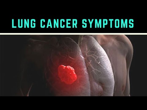 ▓ Lung Cancer █ Life Expectancy █ Causes Types █ Symptoms ✫ Stages ✔