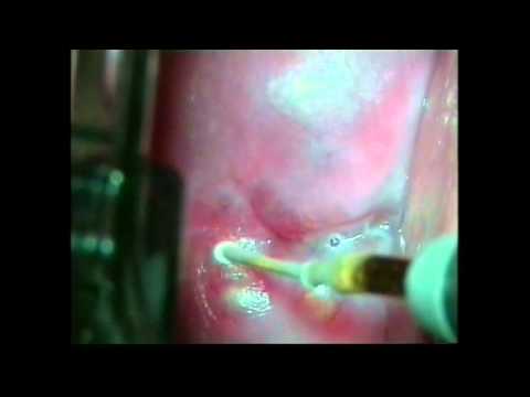 Gynaecology 4