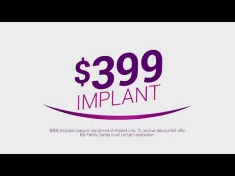 $399 Dental Implants #3