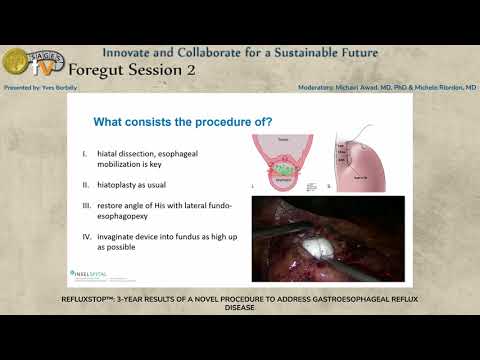 REFLUXSTOP™: 3-YEAR RESULTS OF A NOVEL PROCEDURE TO ADDRESS GASTROESOPHAGEAL REFLUX DISEASE