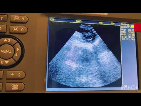 At home ultrasound machine to count puppies
