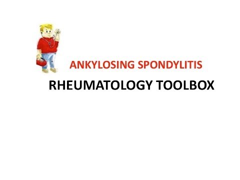 ANKYLOSING SPONDYLITIS