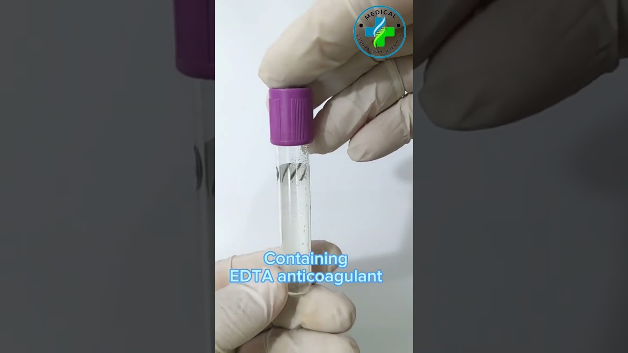 CBC tube | EDTA Anticoagulants | EDTA Vial | CBC test | Blood collection tube | EDTA vacutainer