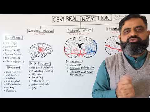 Stroke Urdu/Hindi medium @prof.masoodfuzail| Cerebral Infarction | Types of Stroke | Brain Stoke