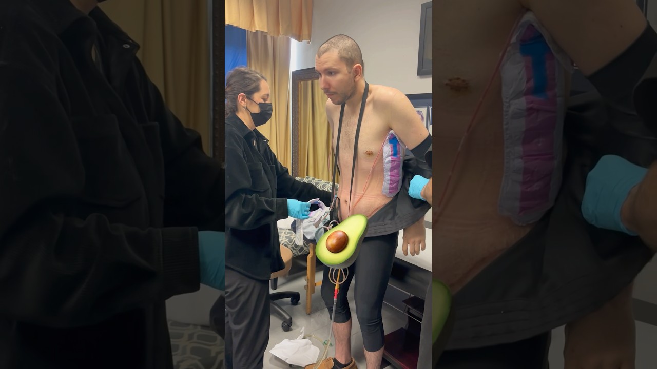 I survived FOUR Surgeries 🩸💉 Body Lift, Arm Lift, Thigh Lift, Torso Lift