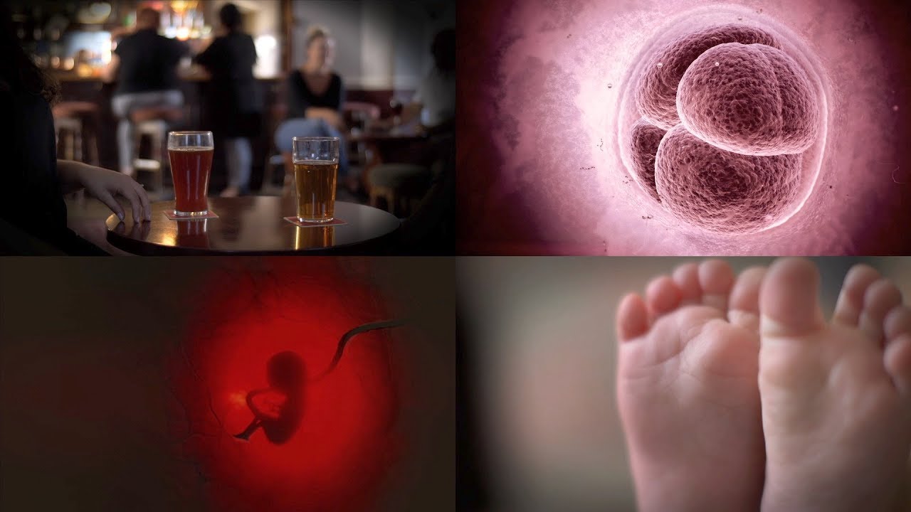 #BeAware FASD