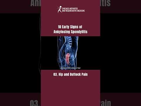 Hip and buttock pain | 10 Early Signs of Ankylosing Spondylitis You Shouldn’t Ignore!