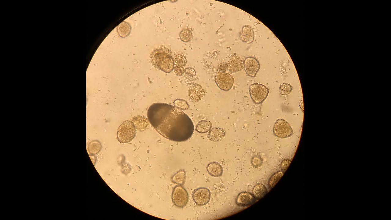 Playing With Pollen Under a Microscope