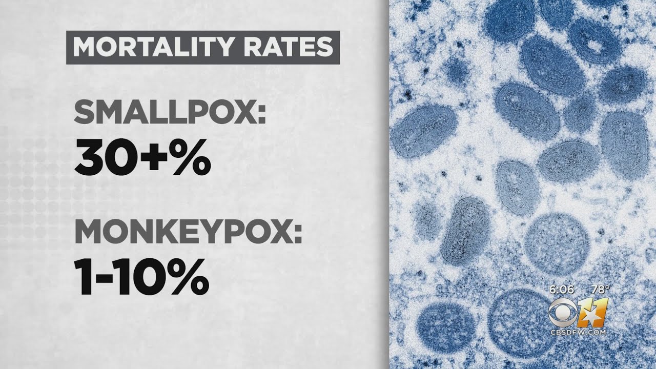 What is monkeypox and should you worry?