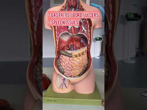 Differential diagnosis for a Left upper quadrant pain #doctor #mbbs #anatomy #medicine