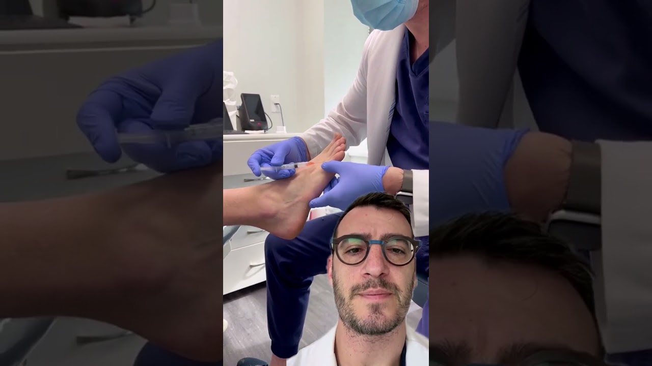 #neuroma #footpain