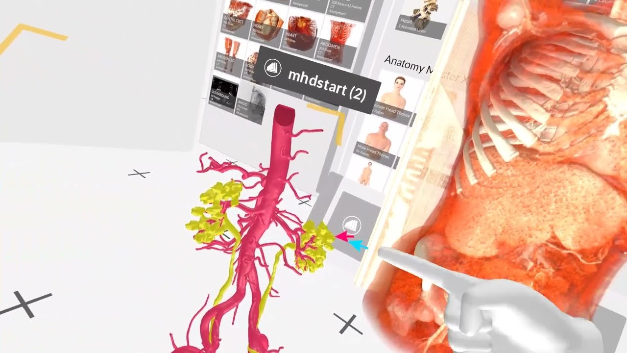 3D Data in AR and VR: Import Data From Fujifilm Synapse 3D