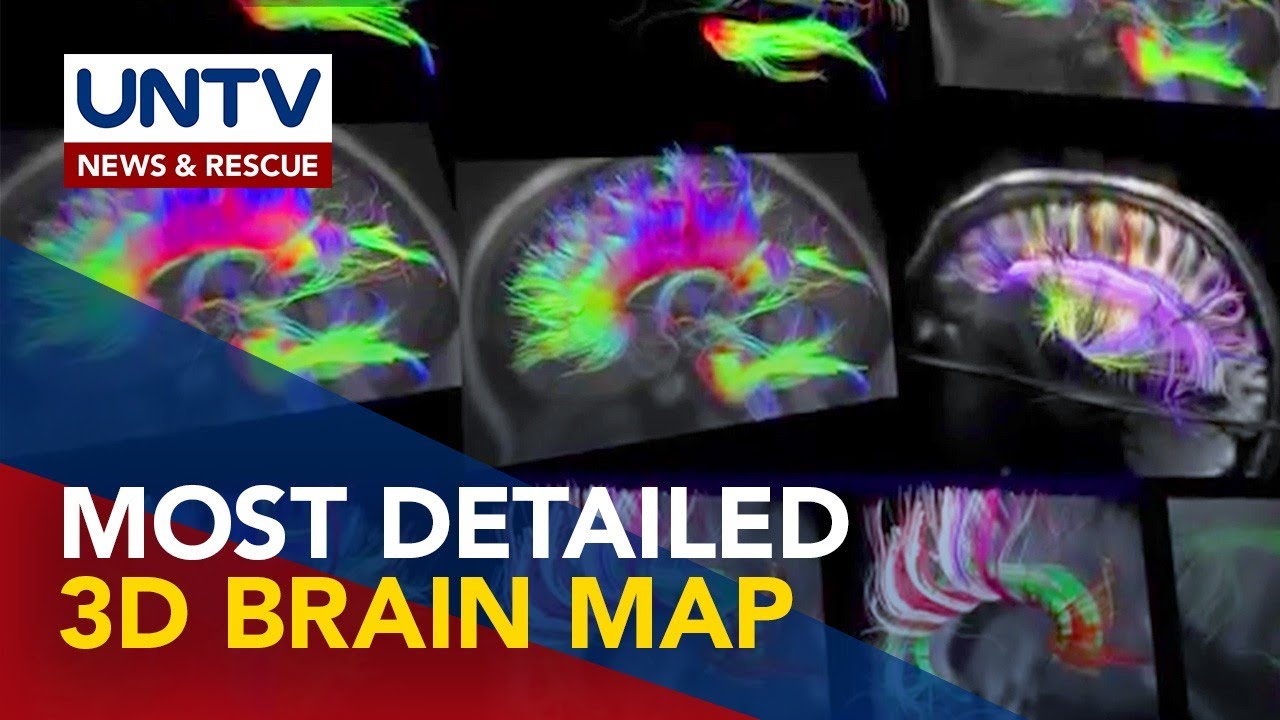 Google, Harvard unveils most detailed map of the human brain