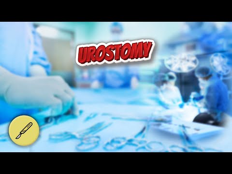 Urostomy - Everything Surgeries ✅😬⁉️