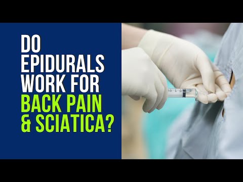 Do Epidurals Work for Back Pain and Sciatica?