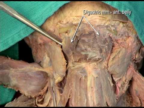 1.2 Step 6. Infrahyoid and digastric muscles; submandibular gland