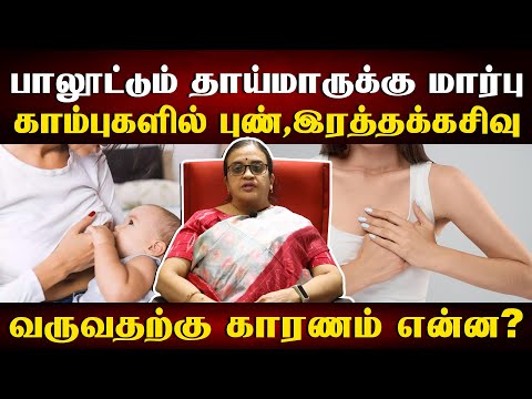 தாய்ப்பால் கொடுக்கும் போது முலைக்காம்பில் புண் வருமா? | How to treat sore nipples for breastfeeding