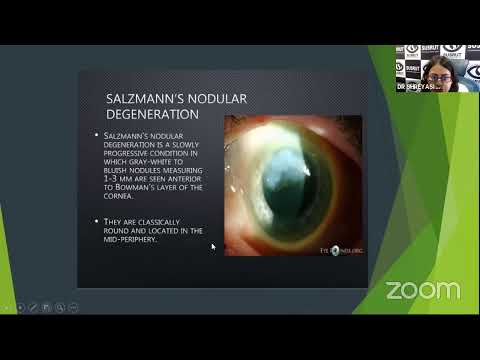 Cornea_OCTC
