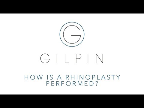 How Is A Rhinoplasty Performed? | Dr. David Gilpin