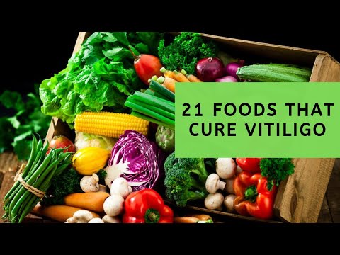 21 Lists of food for cure vitiligo