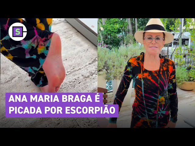 Ana Maria Braga detalha picada de escorpião: 'Não estava no mato'