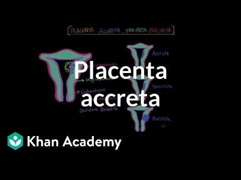 Placenta accreta | Reproductive system physiology | NCLEX-RN | Khan Academy