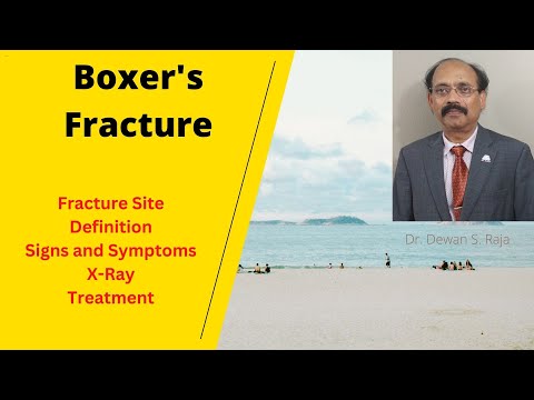 Boxer's Fracture