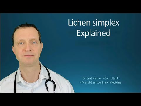 Lichen Simplex Explained #51