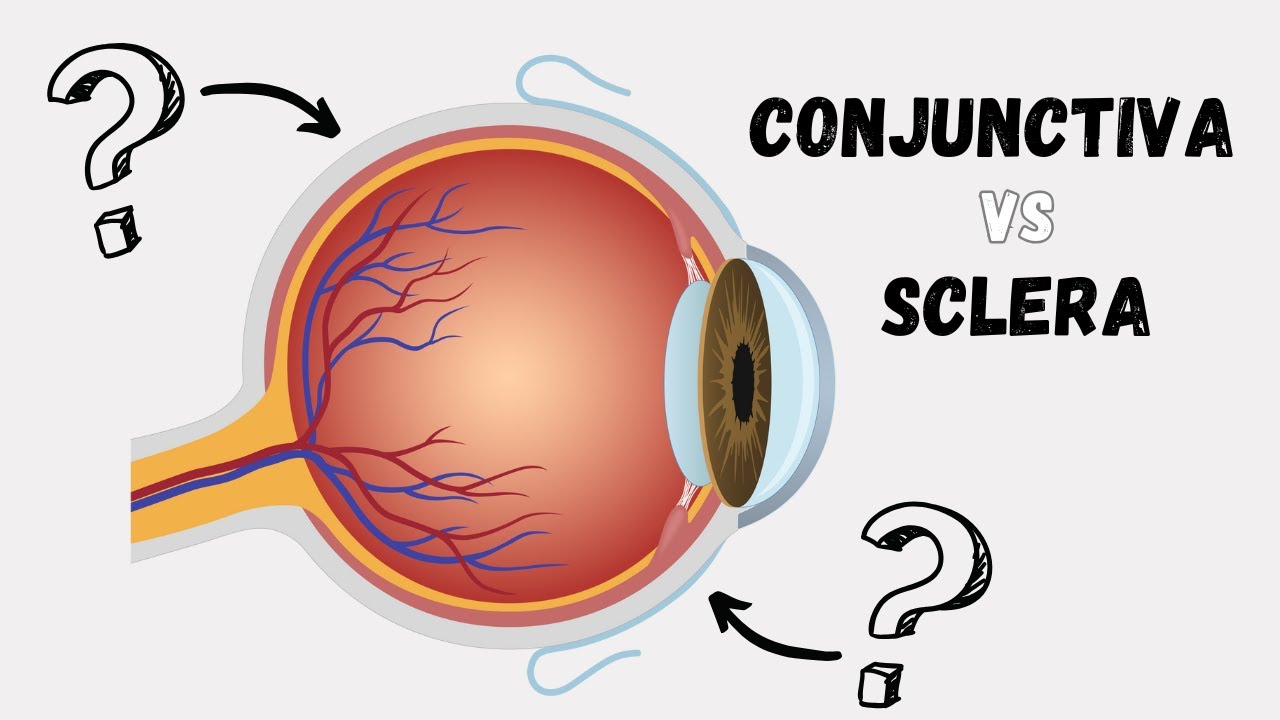 Eye Anatomy Simplified: Conjunctiva vs. Sclera