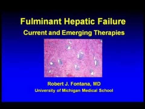 Fulminant Hepatic Failure Current and Emerging Therapies