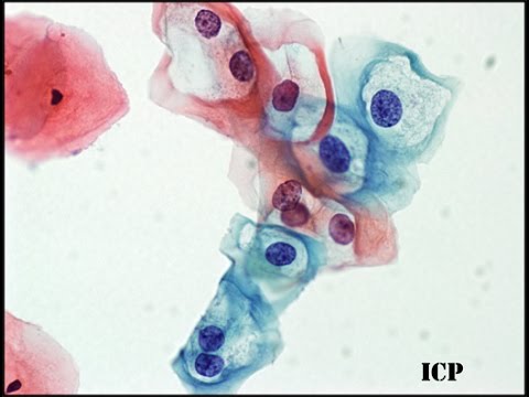 Military Cytotechnologists and CANCER VIDEO 2015