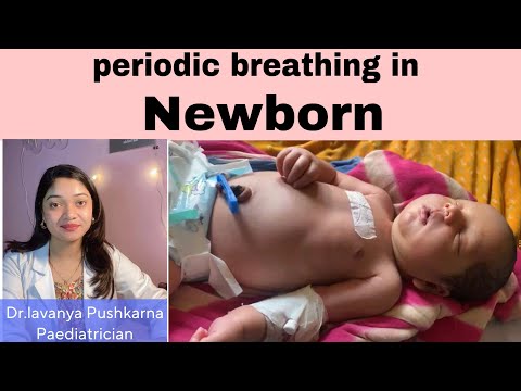 Newborn with periodic breathing | common neonatal conditions | the baby doctor #newborn #shorts