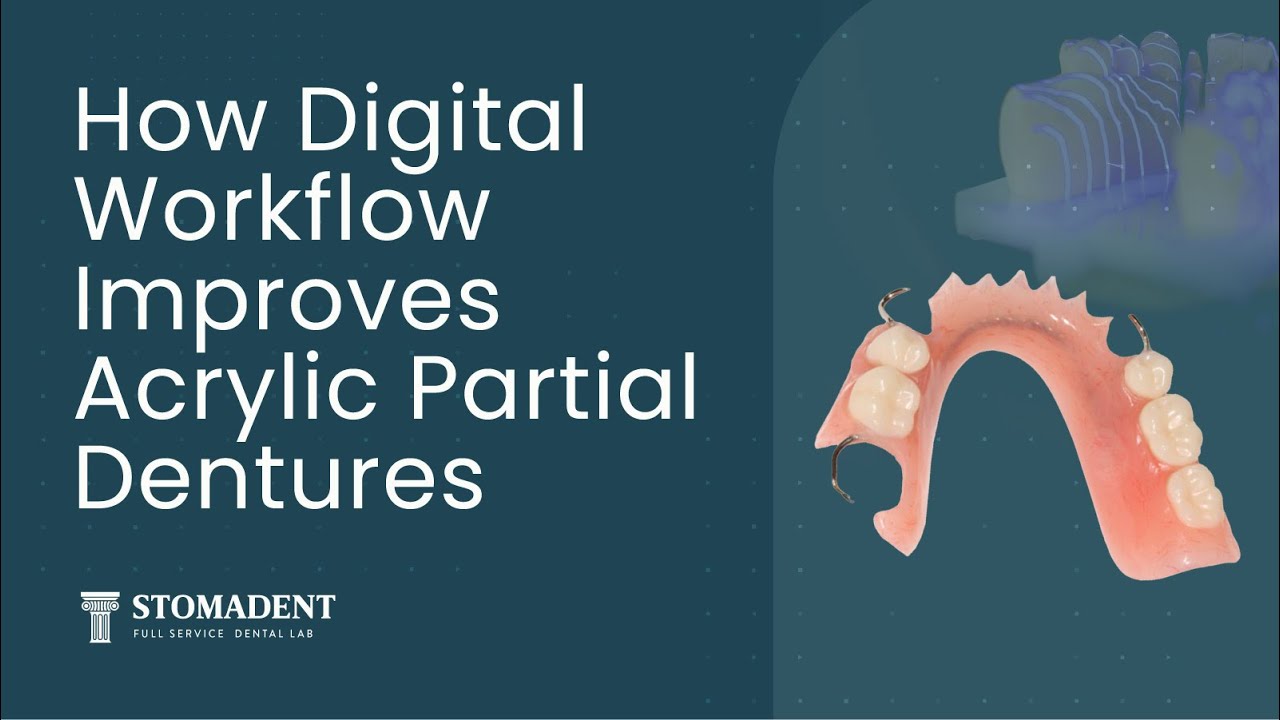 How Digital Workflow Improves Acrylic Partial Dentures