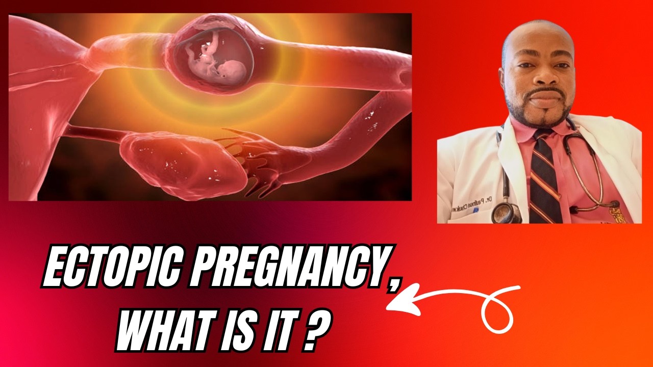 ECTOPIC PREGNANCY, WHAT IS IT?1080p caption