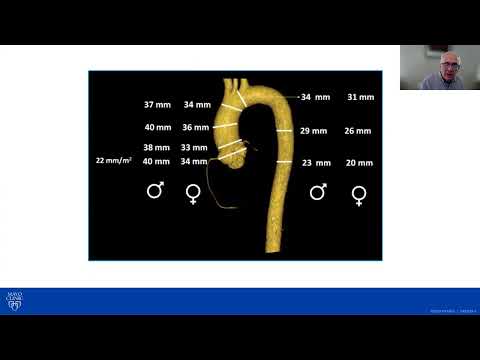 Aorta and Aneurysm Definitions