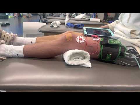 BFR and NMES for Improving Quadriceps Atrophy after Knee Surgery | Short Arc Quads