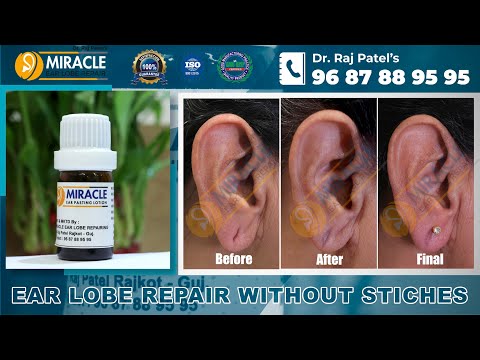 Ear Treatment, ENT Doctors in India