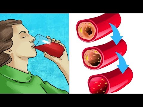 Amazing Way To Unclog Your Arteries From Cholesterol Naturally