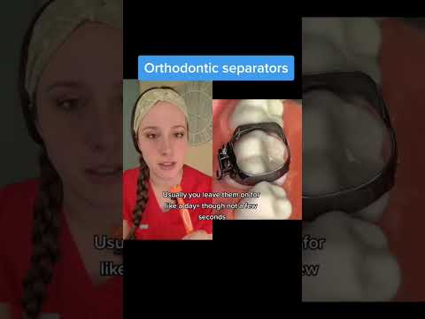 Orthodontic rubber band spacers #toothspacers #braces #orthodontics #dentist #teethcleaning