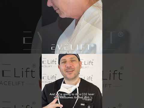 EVE Lift™ Patient Michelle Just 6 Days After | Eden Plastic Surgery: Dr. Ali Charafeddine, MD