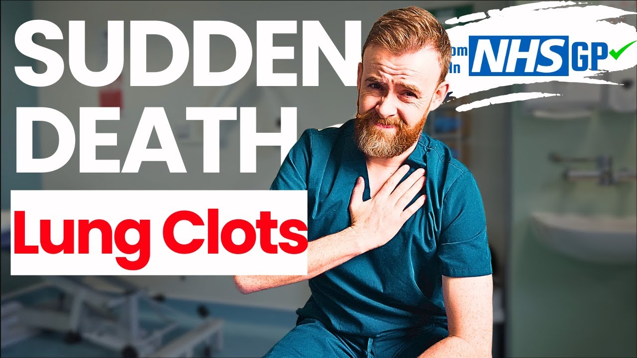 Pulmonary Embolism🫁: A Classic Case Dissected 🔎