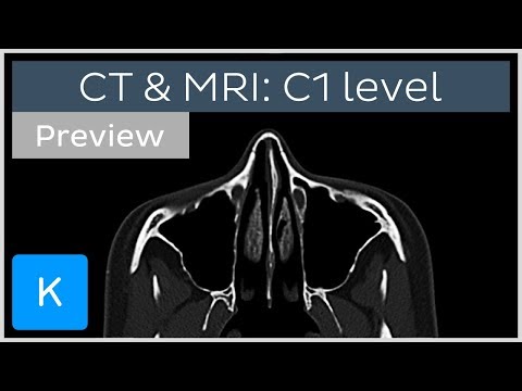 Medical imaging at the level of C1: CT and MRI (preview) - Radiological Anatomy | Kenhub
