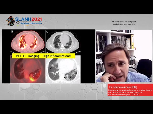 CONGRESO SLANH 2023 - Sociedad Latinoamericana de Nefrología e Hipertensión