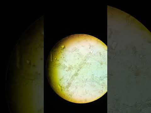 Hyaline casts in Urine at 40x #microscope